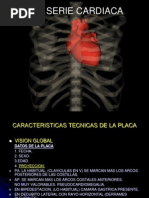 Serie Ósea Metastásica | Metástasis | Cáncer de pulmón