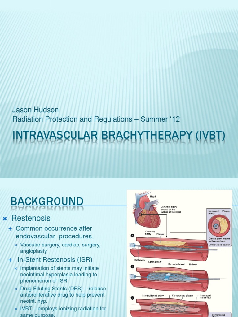 IVBT Systems and Regulations | PDF | Calibration | Dosimetry
