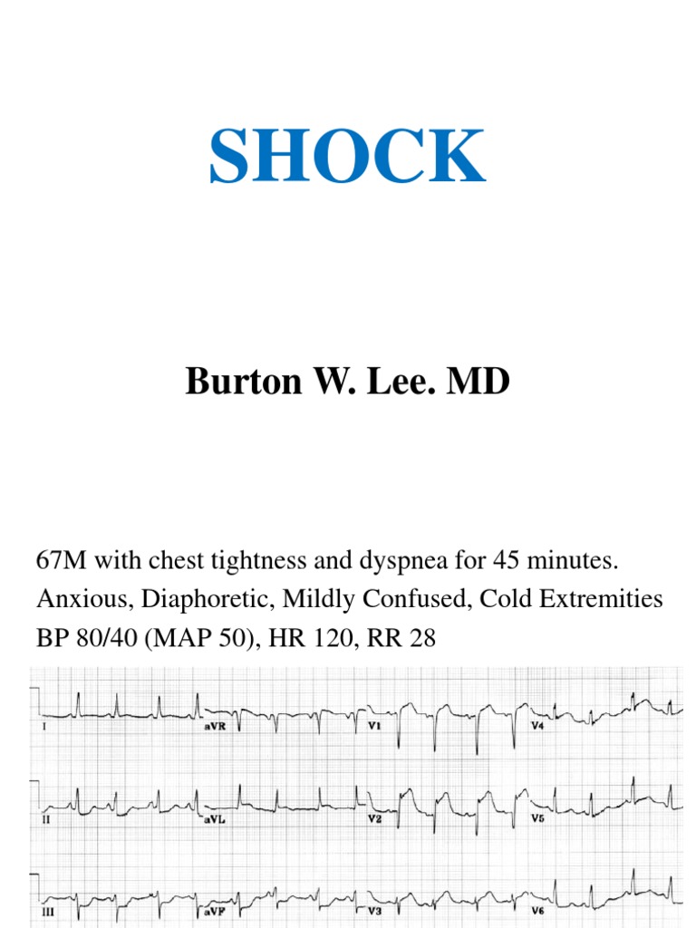 Cardiogenic Shock | PDF | Shock (Circulatory) | Cardiovascular System