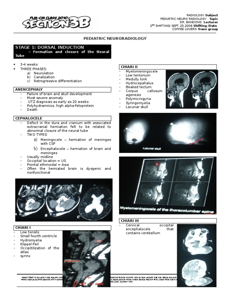 Stage 1: Dorsal Induction: Pediatric Neuroradiology | PDF | Corpus ...