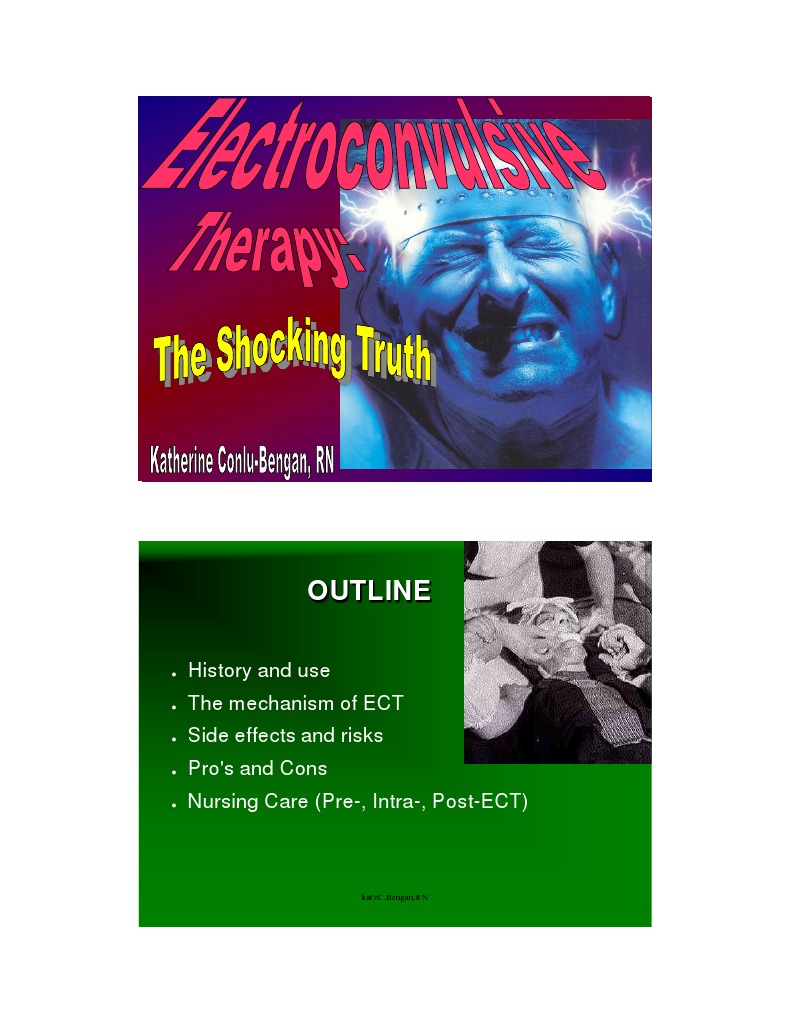 Outline: History and Use The Mechanism of ECT Side Effects and Risks ...