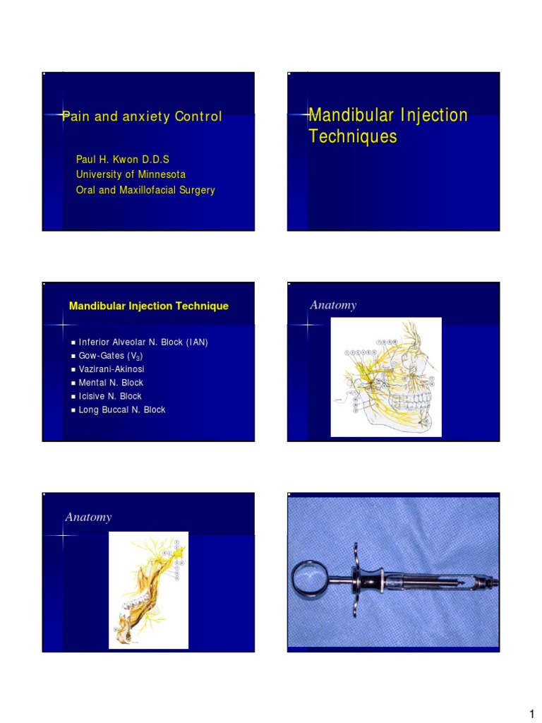 Mandibular Injection Techniques Overview | PDF | Mouth | Face
