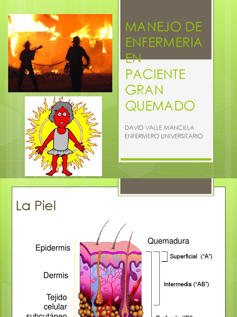 Manejo de Enfermeria en Paciente Gran Quemado | PDF | Quemar | Epidermis