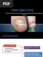 Onicomicosis: Tipos y Tratamiento | PDF | Epidemiología | Medicina