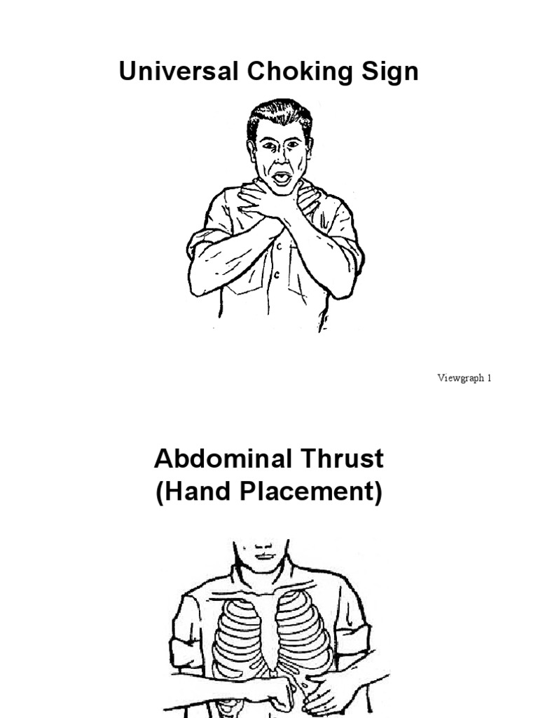 Universal Choking Sign: Viewgraph 1 | PDF