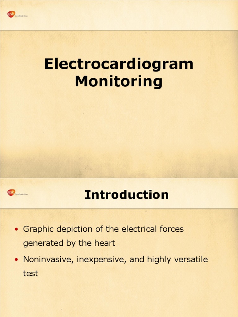 ECG Monitoring | PDF | Electrocardiography | Cardiac Arrhythmia