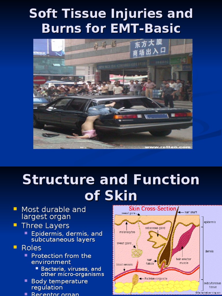Soft Tissue Injuries and Burns For EMT-Basic | PDF | Burn | Wound