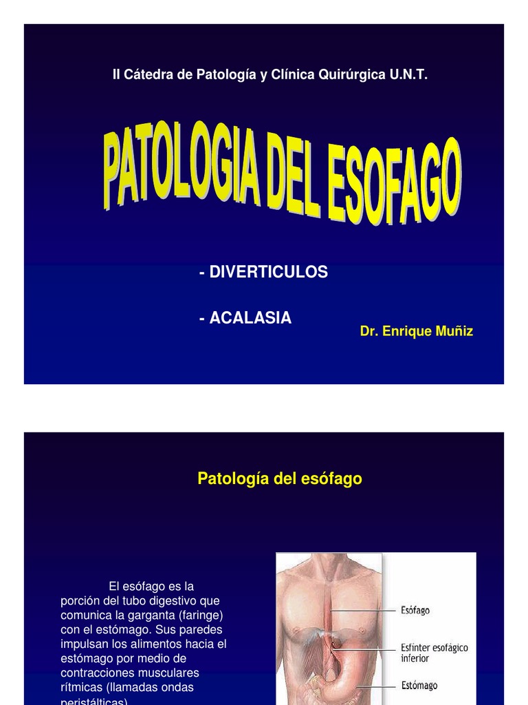 Esofago, Diverticulo y Acalasia | PDF | Esófago | Anatomía