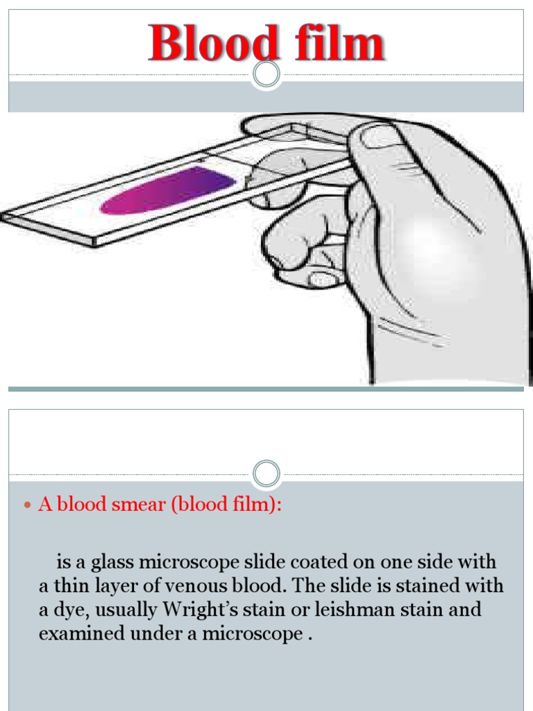 Blood Film | PDF | Medical Specialties | Clinical Medicine