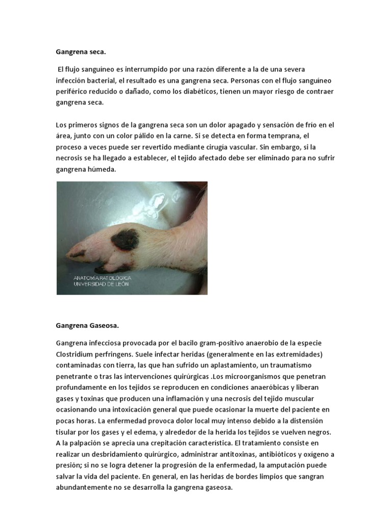 Gangrena Seca | PDF
