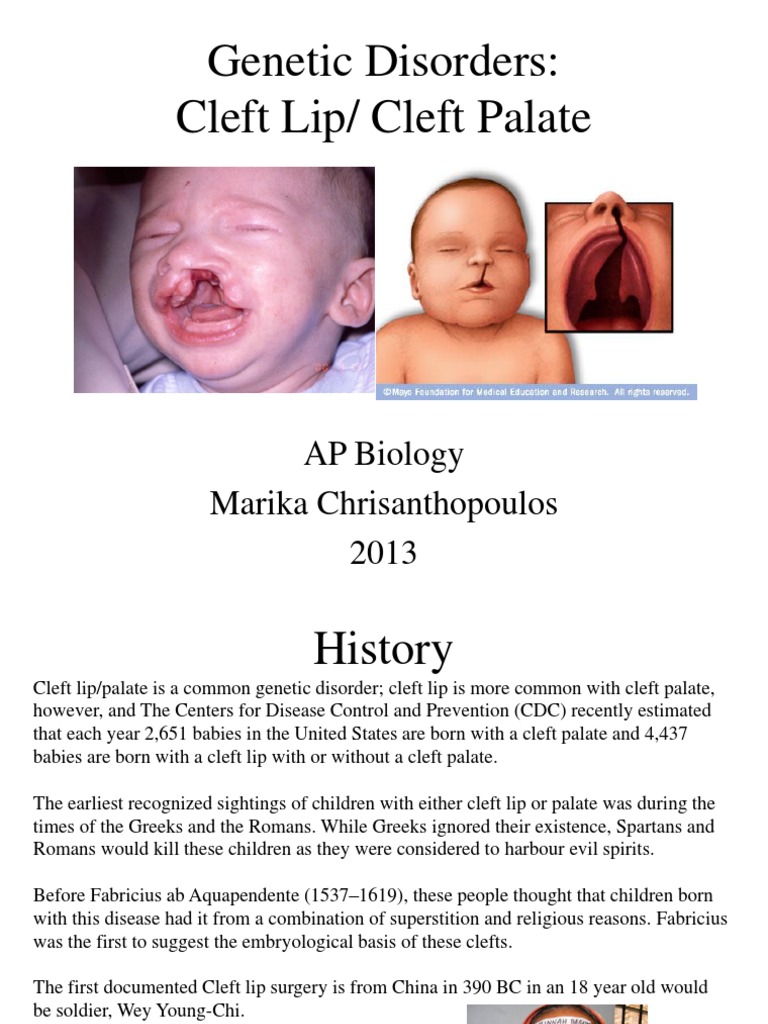 Cleft Lip/Palate: AP Bio Overview | PDF | Diseases And Disorders ...