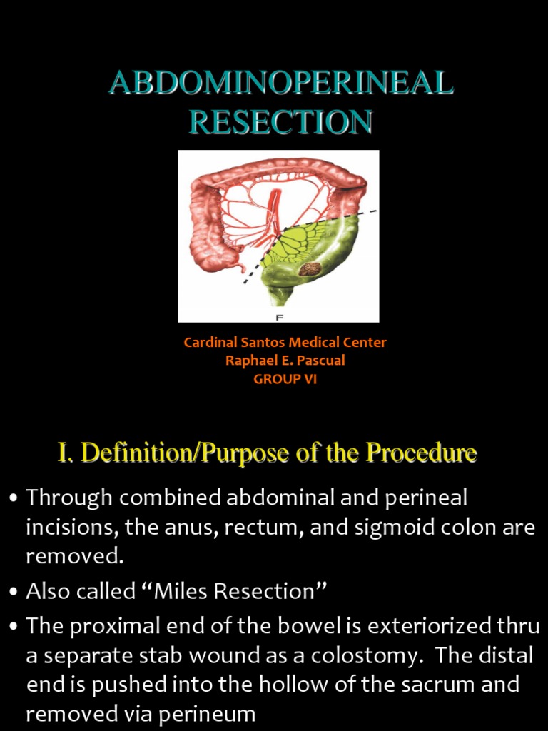 Laparoscopic Abdominoperineal Resection | PDF | Surgical Suture | Abdomen