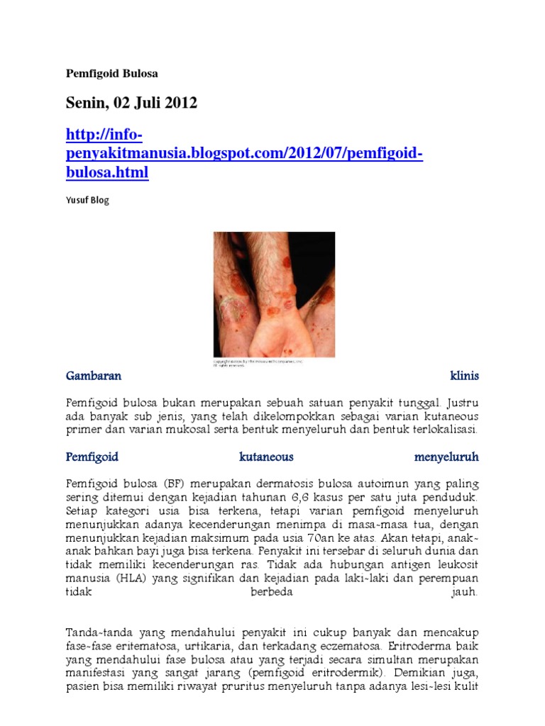 Pemfigoid Bulosa: Gejala dan Varian | PDF