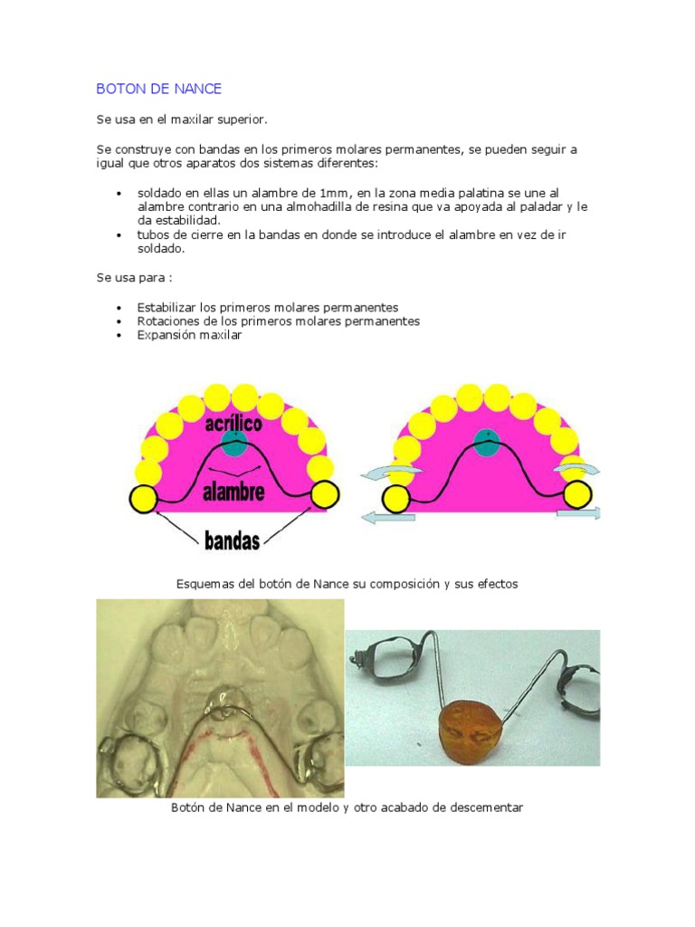 Boton de Nance | PDF