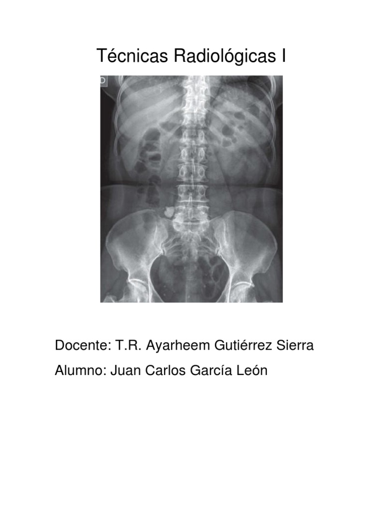 Técnicas Radiológicas I | PDF | Codo | Mano