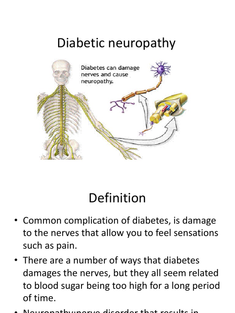 Diabetic Neuropathy | PDF | Peripheral Neuropathy | Nerve
