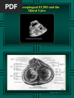 Carpentier's Mitral Valve Classification | PDF | Heart Valve | Thorax ...