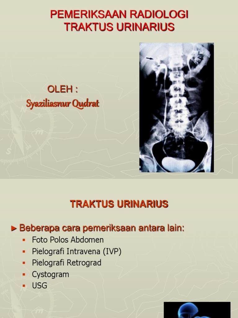 Radiologi Traktus Urinarius | PDF