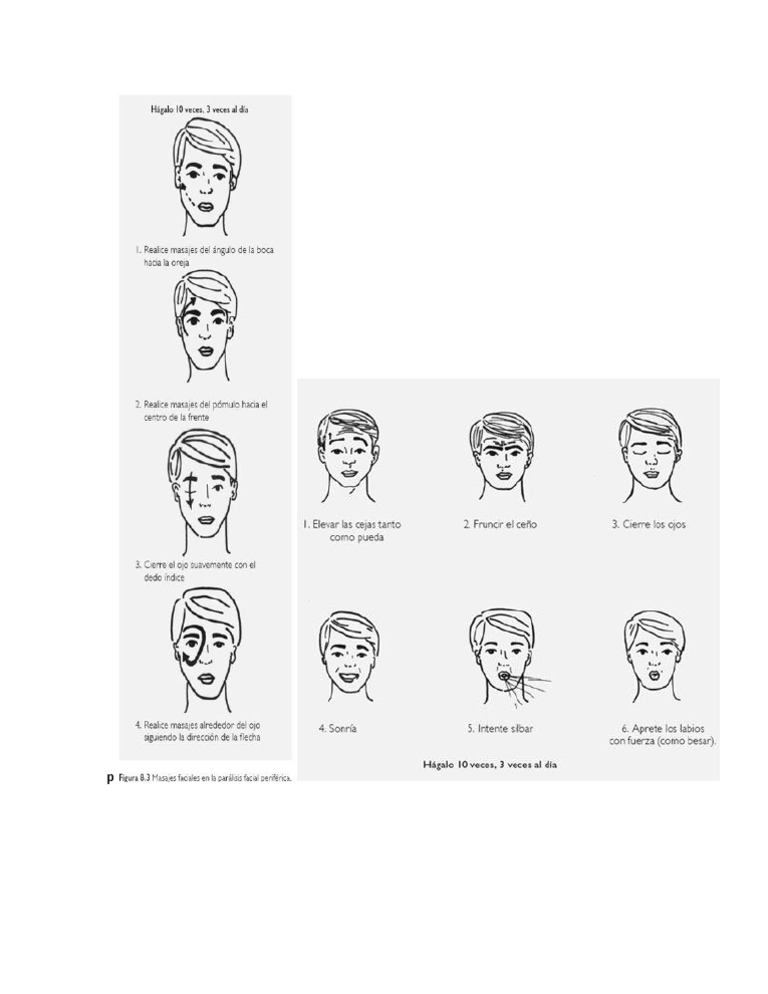 Paralisis Facial De Bell Ejercicios Pdf