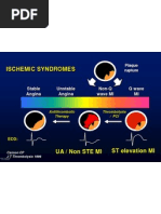 J-Point and STEMI Criteria Explained | PDF | Electrocardiography ...