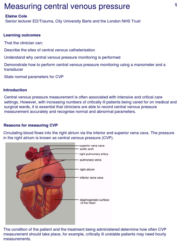 Cvp | Vein | Intravenous Therapy
