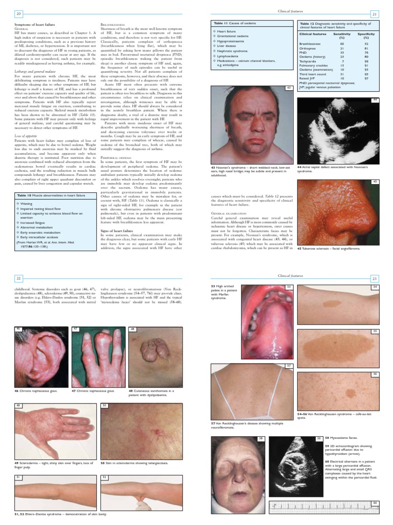 Lethargy and General Malaise: Clinical Features | PDF | Heart Failure ...