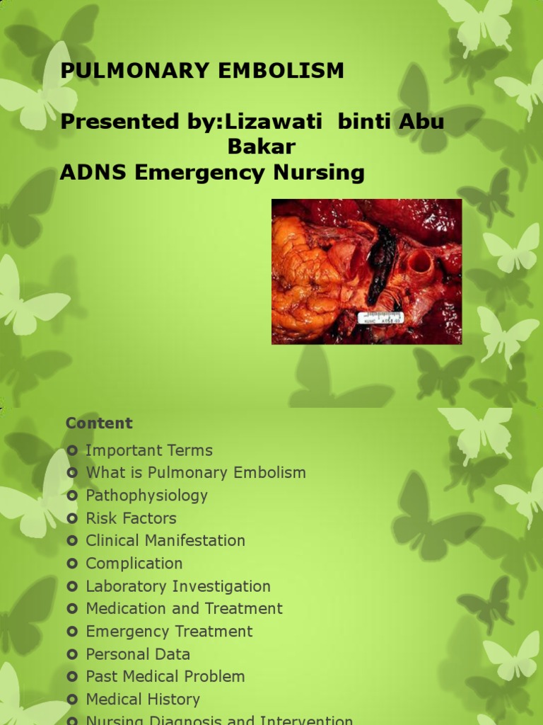 Pulmonary Embolism | PDF | Thrombosis | Embolism