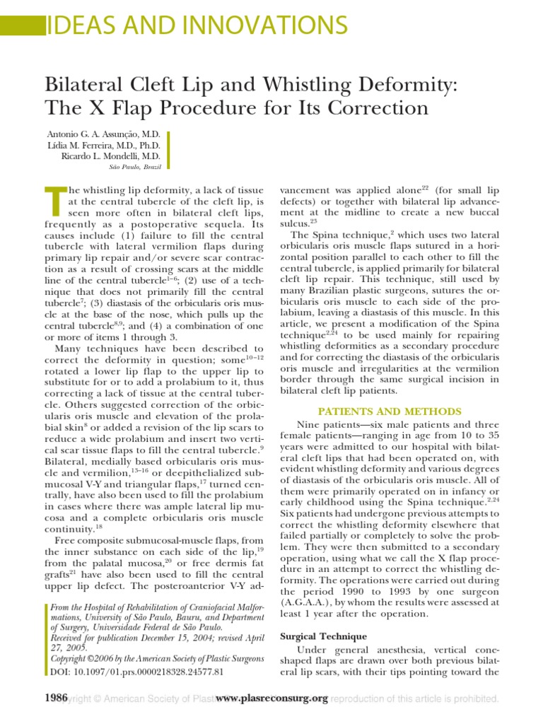Bilateral Cleft Lip and Whistling Deformity The X.43 | PDF | Plastic ...