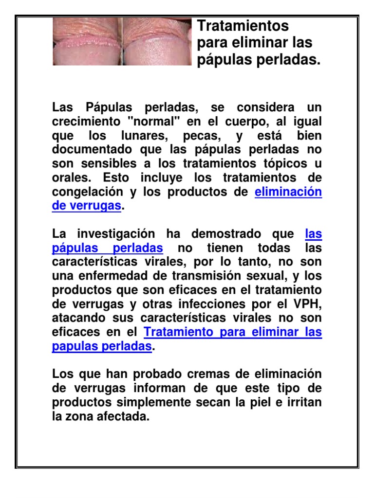 Tratamientos para Eliminar Las Papulas Perladas | PDF