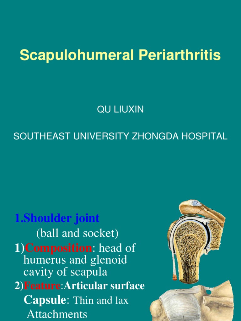 Scapulohumeral Periarthritis Overview | PDF | Shoulder ...