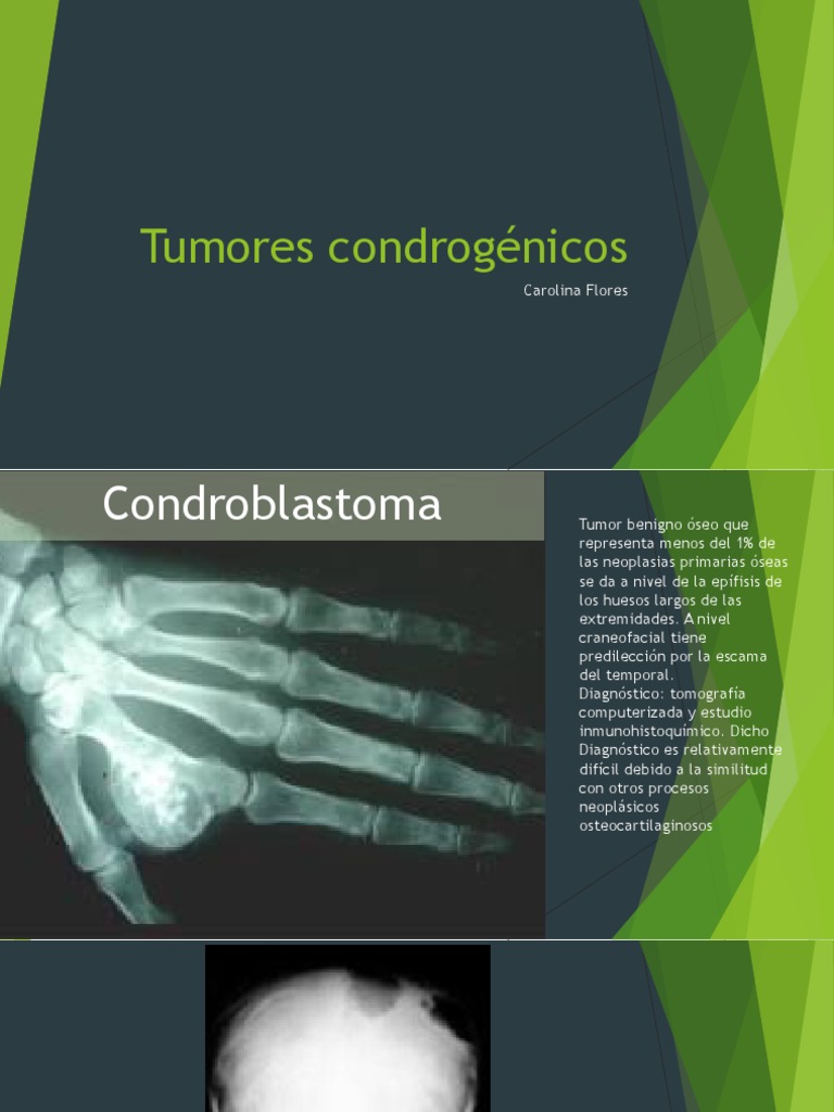 Tumores Condrogénicos: Diagnóstico y Casos Clínicos | PDF | Hueso ...