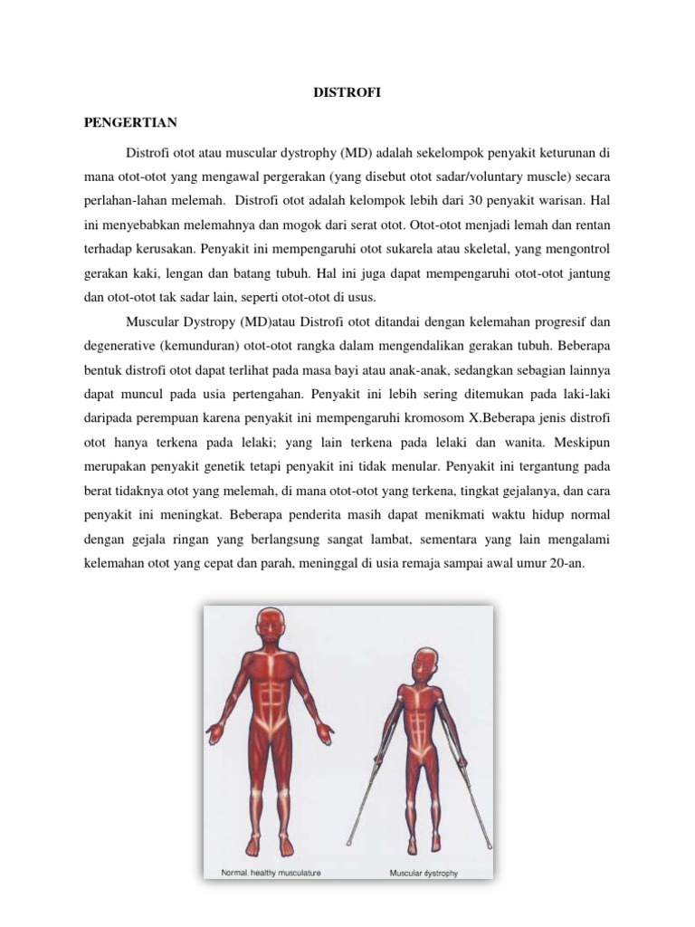 Makalah Distrofi Otot | PDF