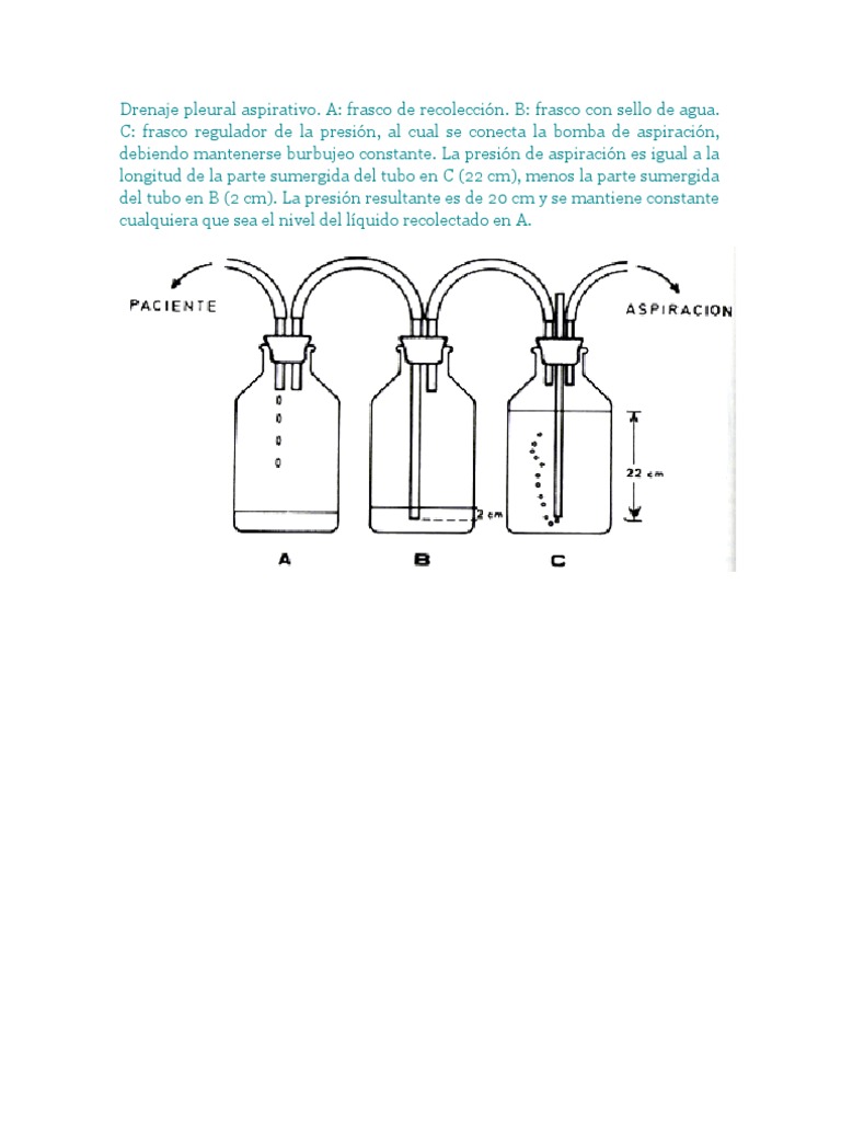 Drenaje Pleural Aspirativo de Sello de Agua | PDF