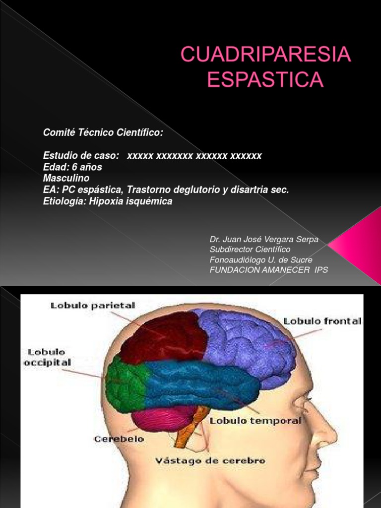 Estudio caso PC espástica Trastorno deglutorio disartria Edad 6 años | PDF