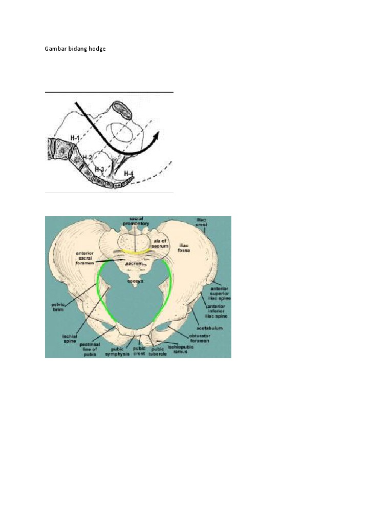 Gambar Bidang Hodge | PDF