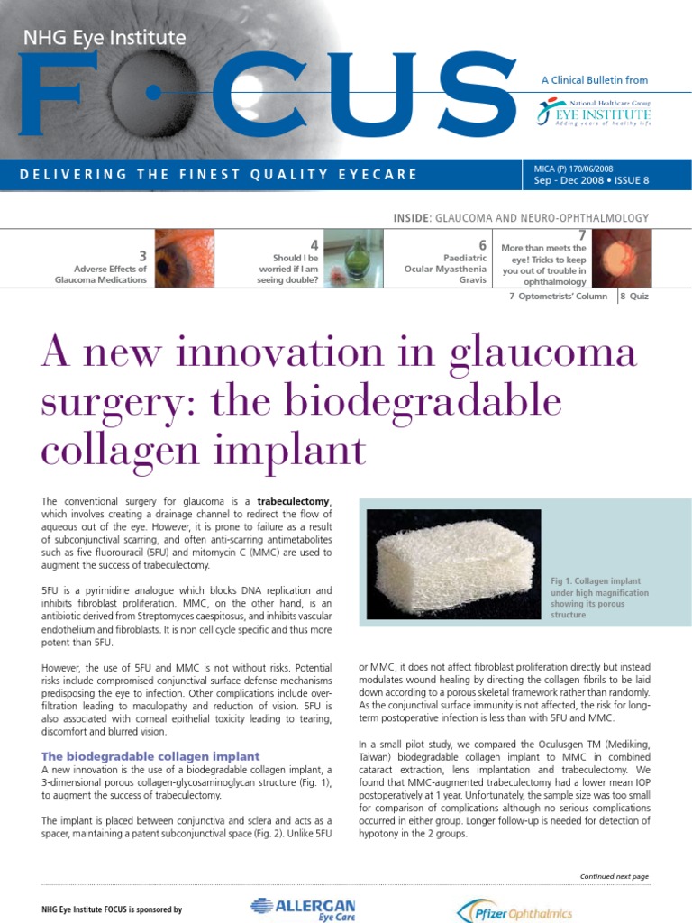 Recent Advances Glaucoma Implants | Download Free PDF | Glaucoma | Visual System