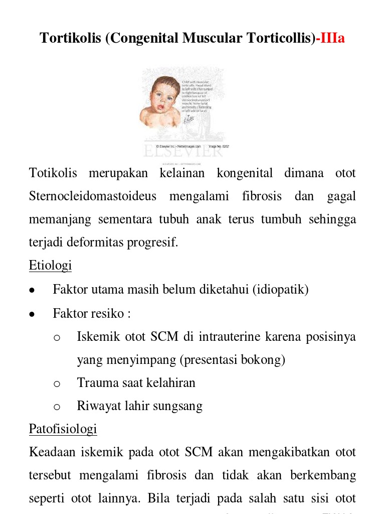 Tortikolis | PDF