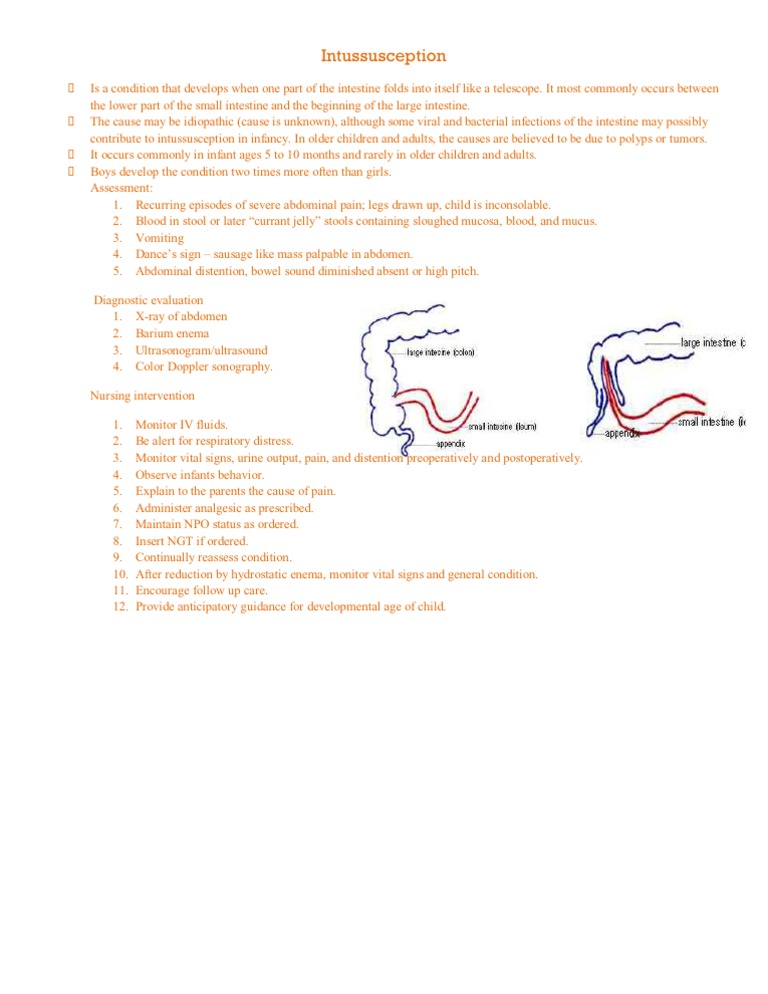 Intussusception | PDF