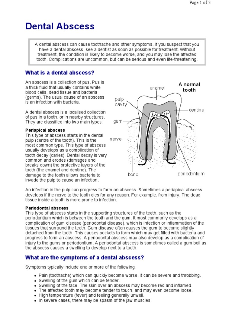 What is a dental abscess?