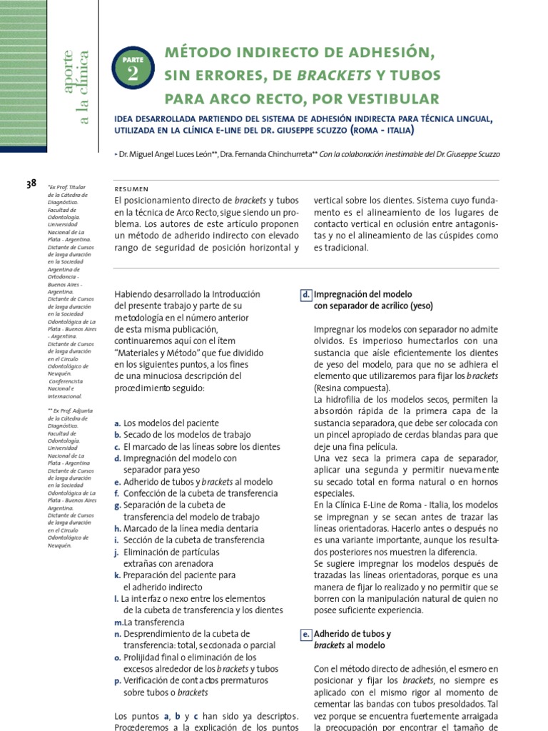 Metodo Indirecto de Adhesion Brackets Part II | PDF | Aluminio | Diente ...