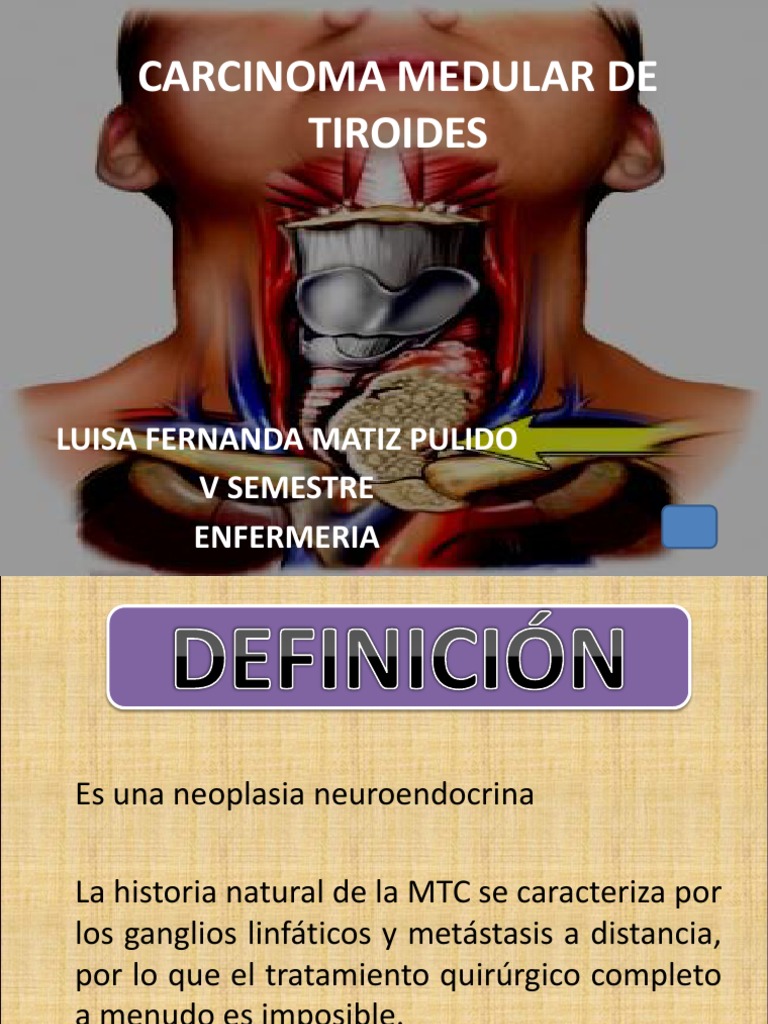 Carcinoma Medular Tiroides Presentacion.