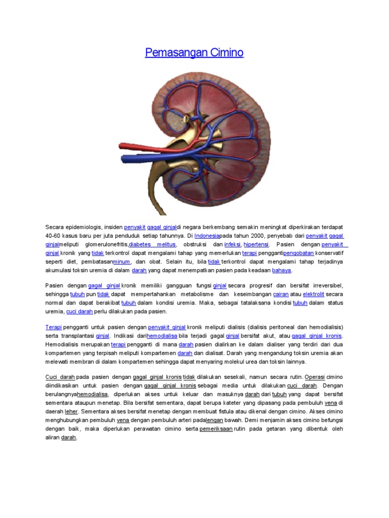 Pemasangan Cimino | PDF