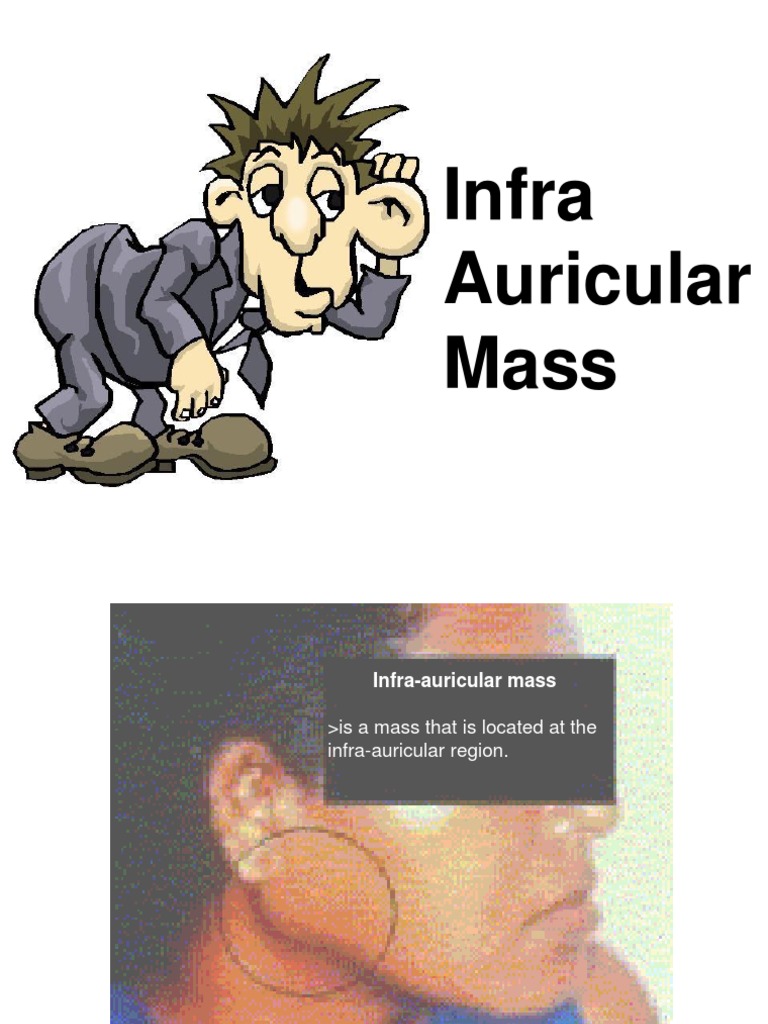 Infra-Auricular Mass Case Pres..ppt | Blood Cell | Blood