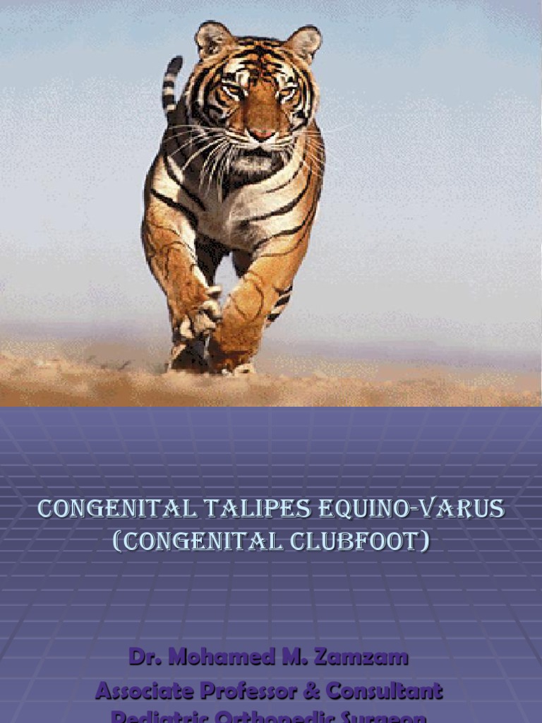 Congenital Talipes Equino-Varus | PDF | Foot | Ankle