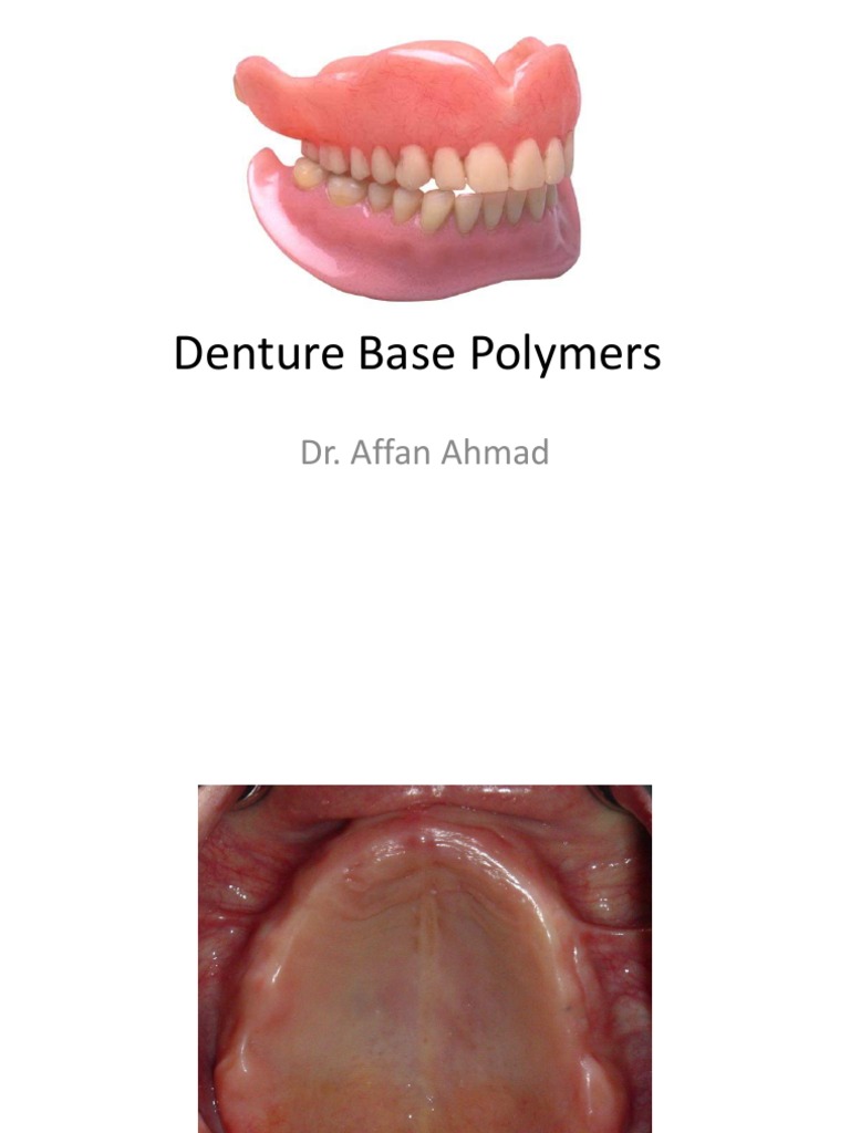 Denture Base Polymers | PDF | Poly(Methyl Methacrylate) | Dentures