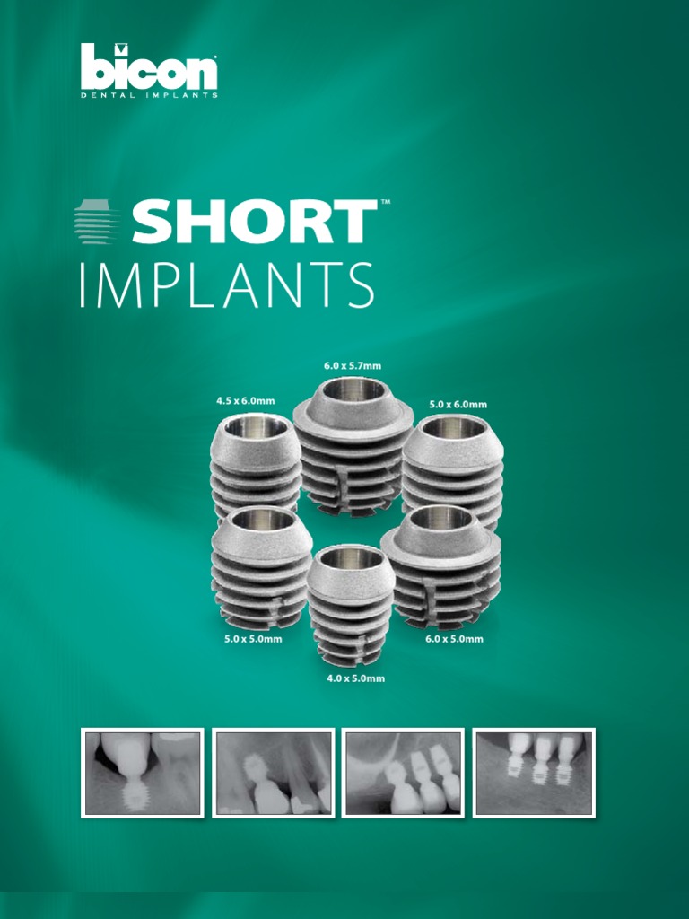 Bicon Short Implant 3 | PDF | Dental Implant | Dentistry Branches