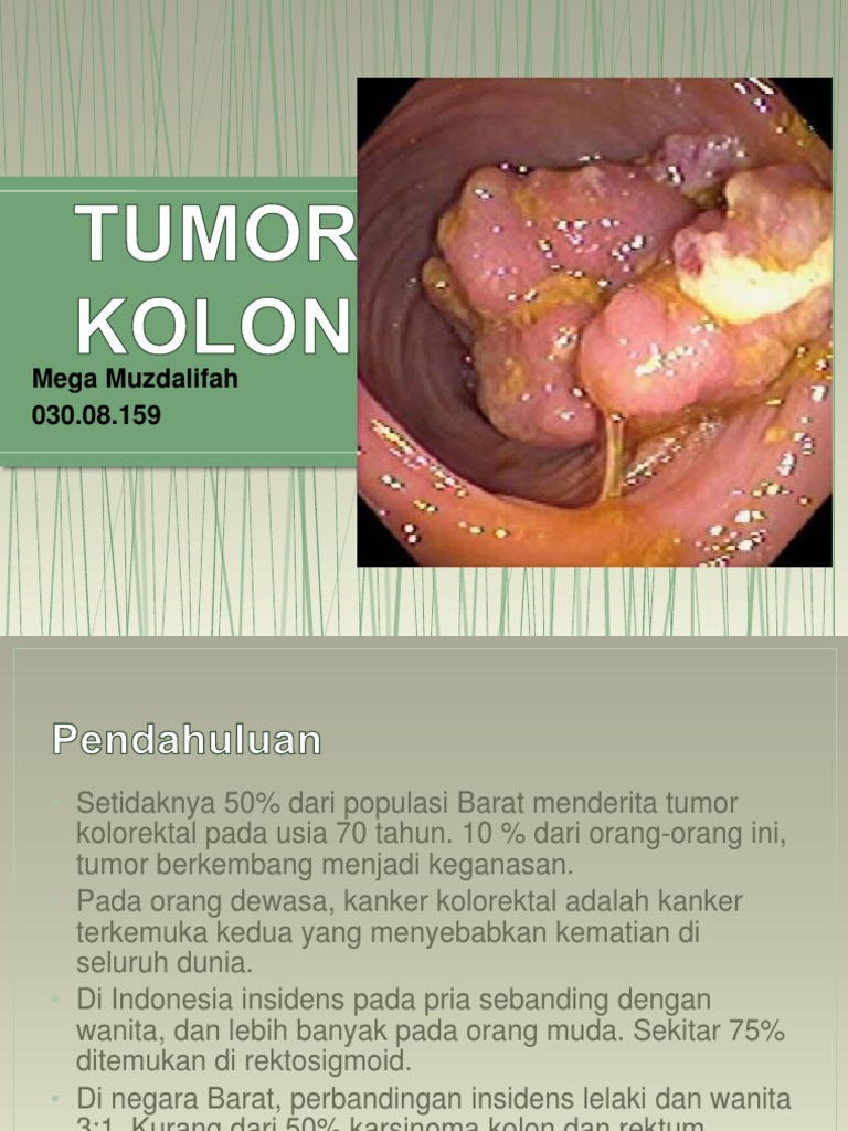 Tumor Kolon | PDF