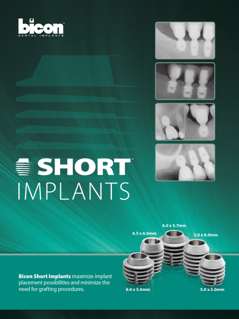 Bicon ShortImplant Clinical | PDF | Dental Implant | Mouth