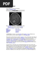 Brain Tumor Report | PDF | Brain Tumor | Central Nervous System