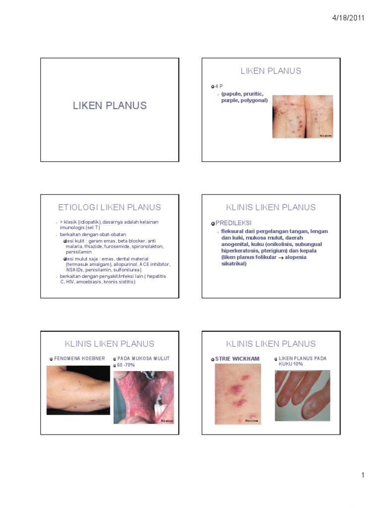 Liken Planus | PDF